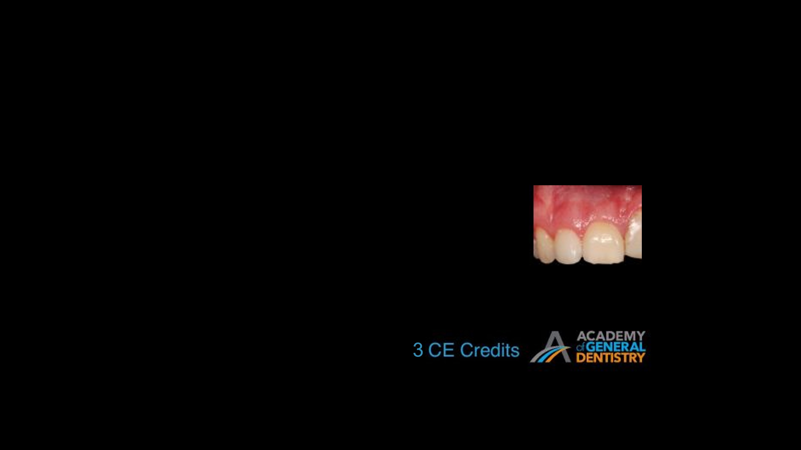Managing Anterior Single Tooth Implants - EOI NYC