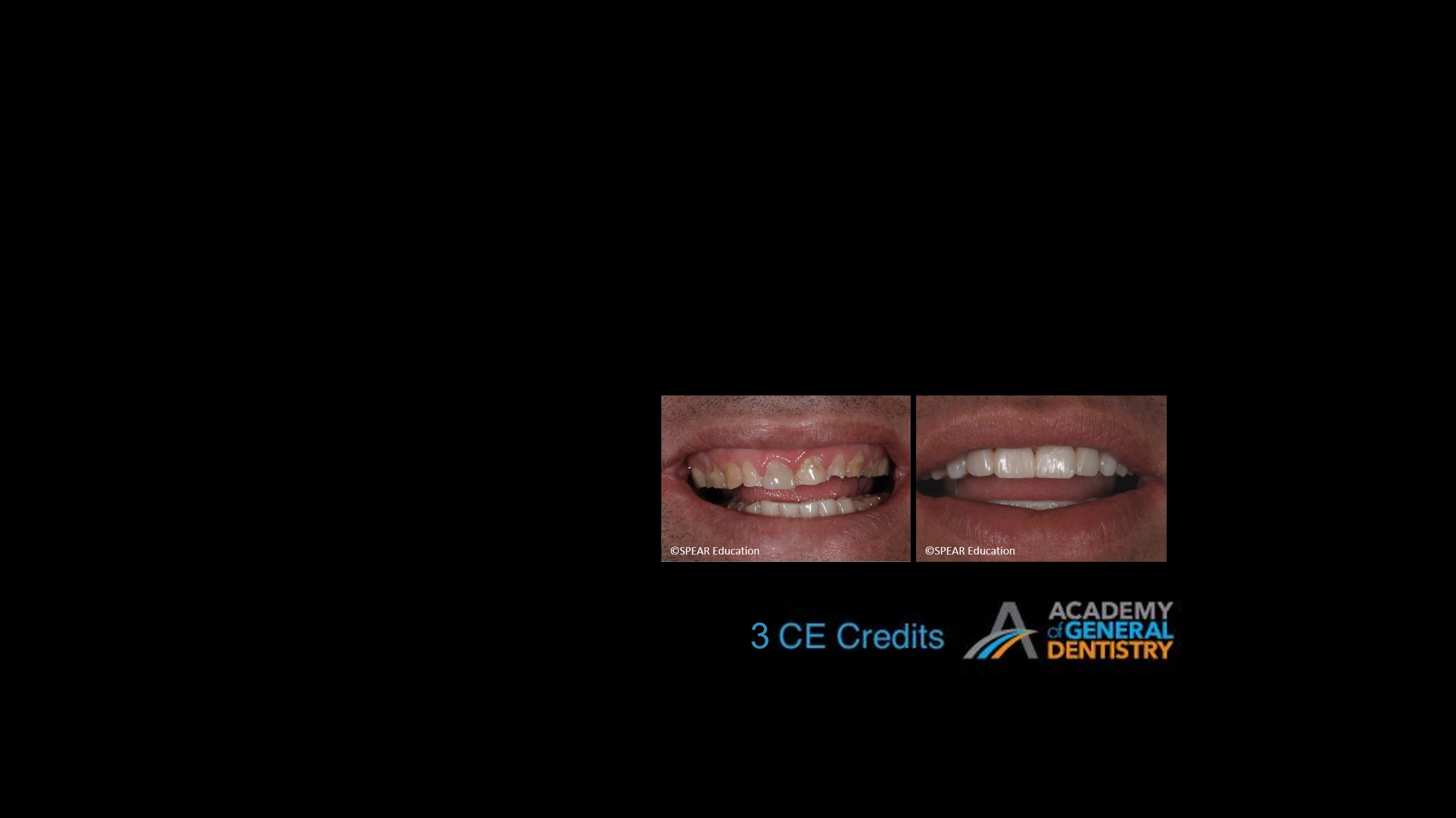 Using Composite to Phase a Complete Case - EOI NYC